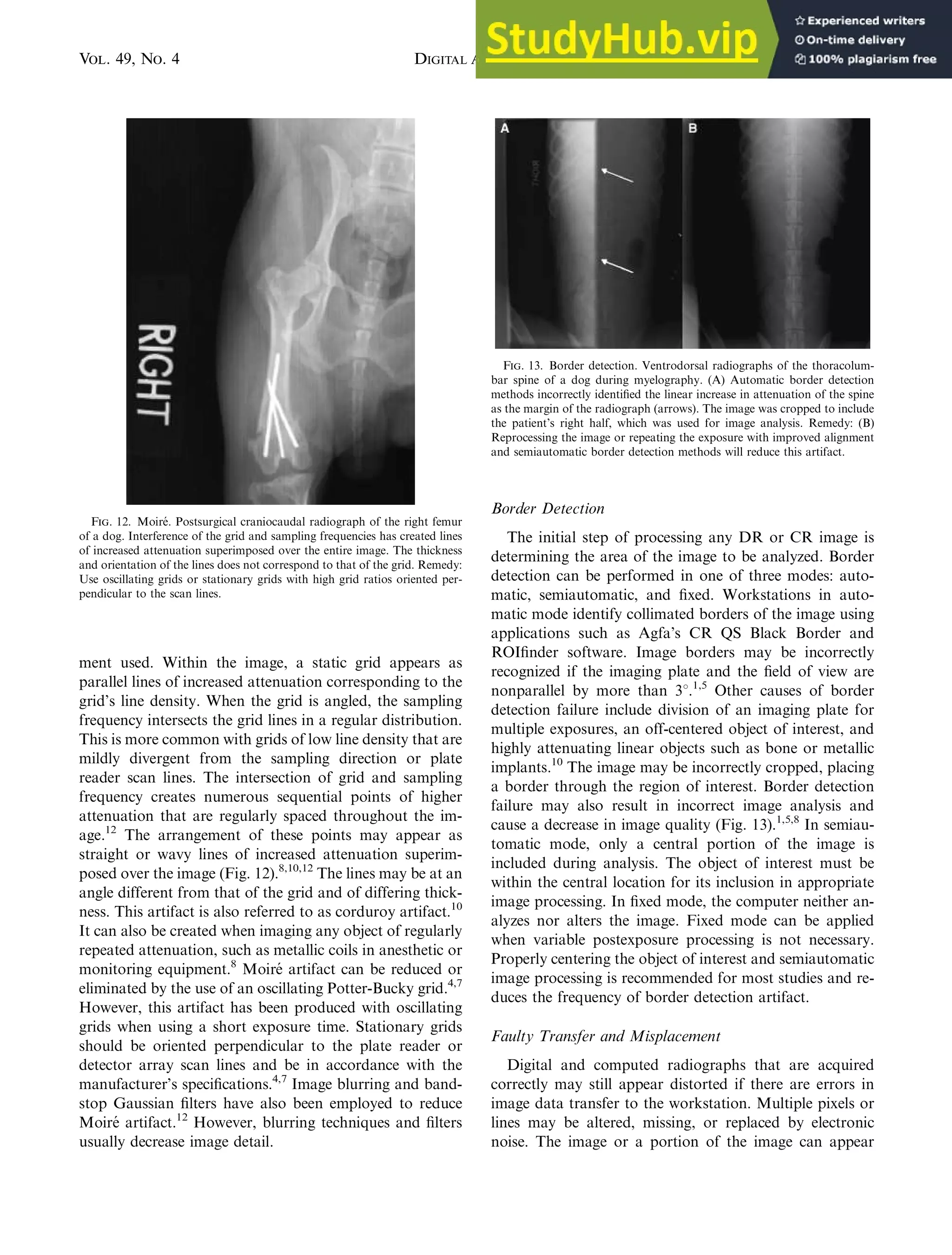 Artifacts In Digital Radiography | PDF