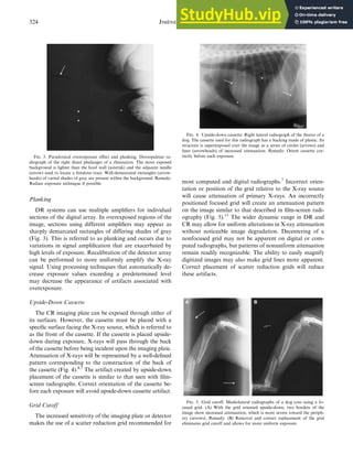 Artifacts In Digital Radiography | PDF