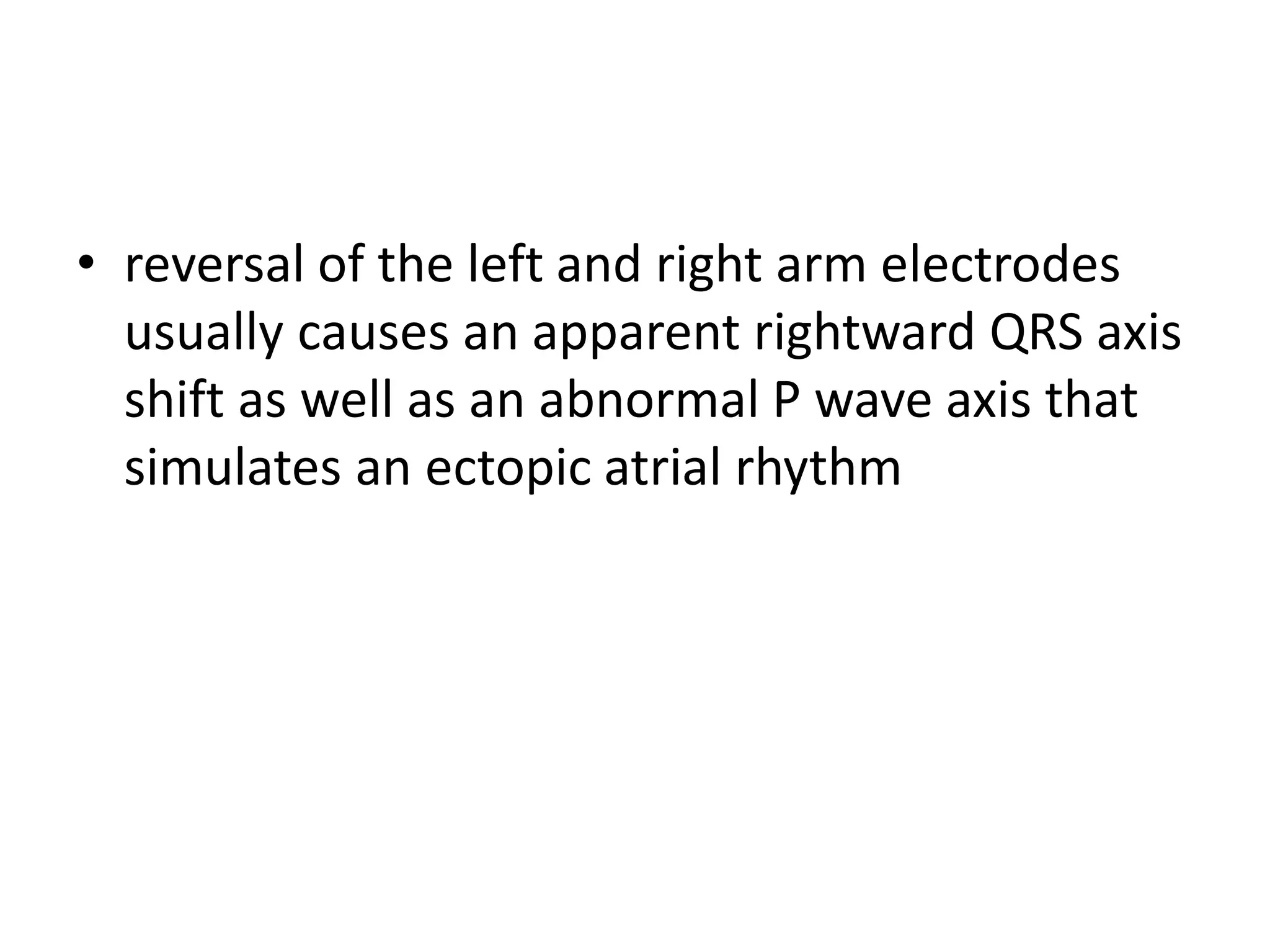 ARTIFACTS IN ECG.pptx