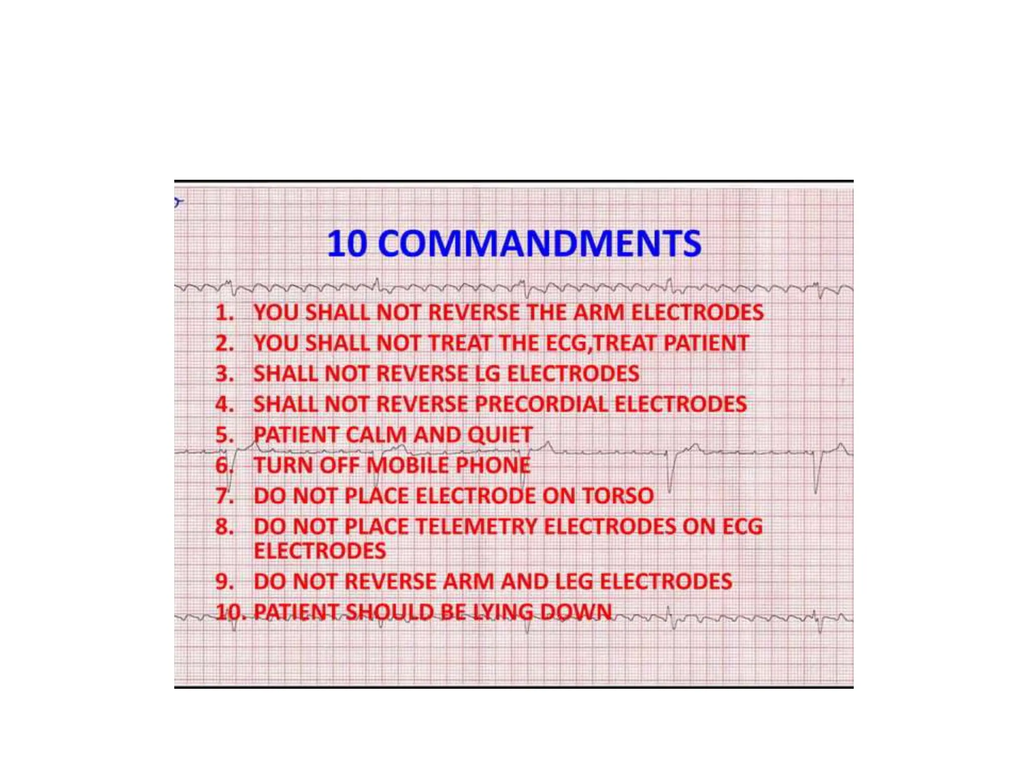 Artifacts In Ecg Pptx Heart And Cardiovascular Diseases Diseases And Conditions