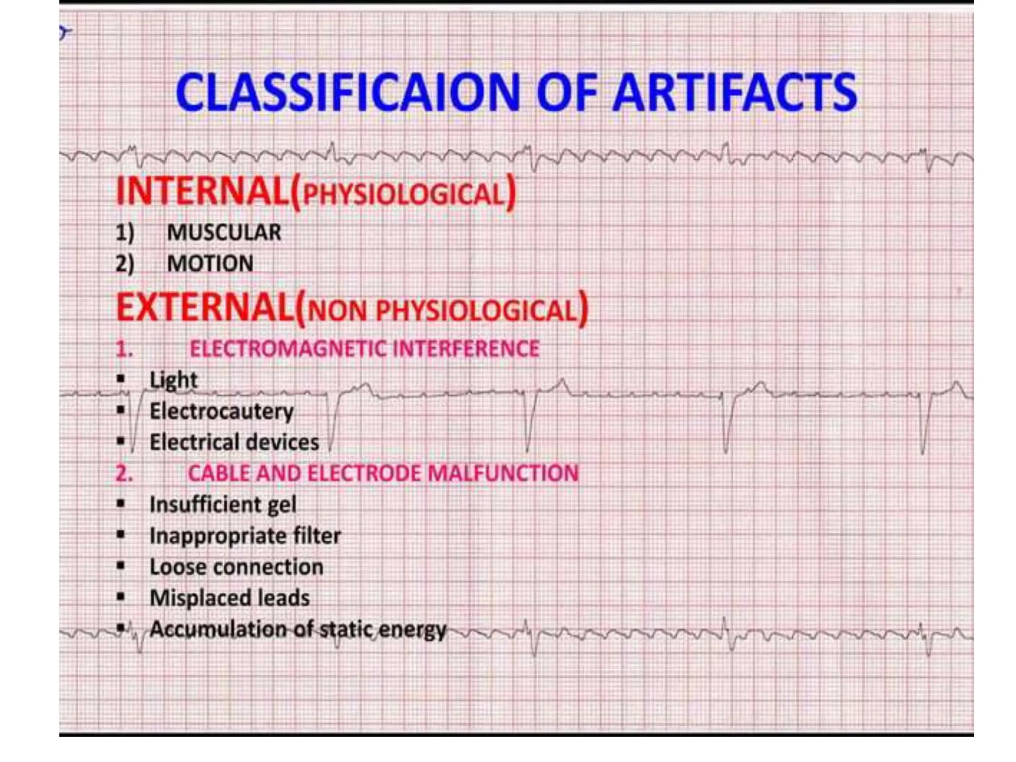 ARTIFACTS IN ECG.pptx