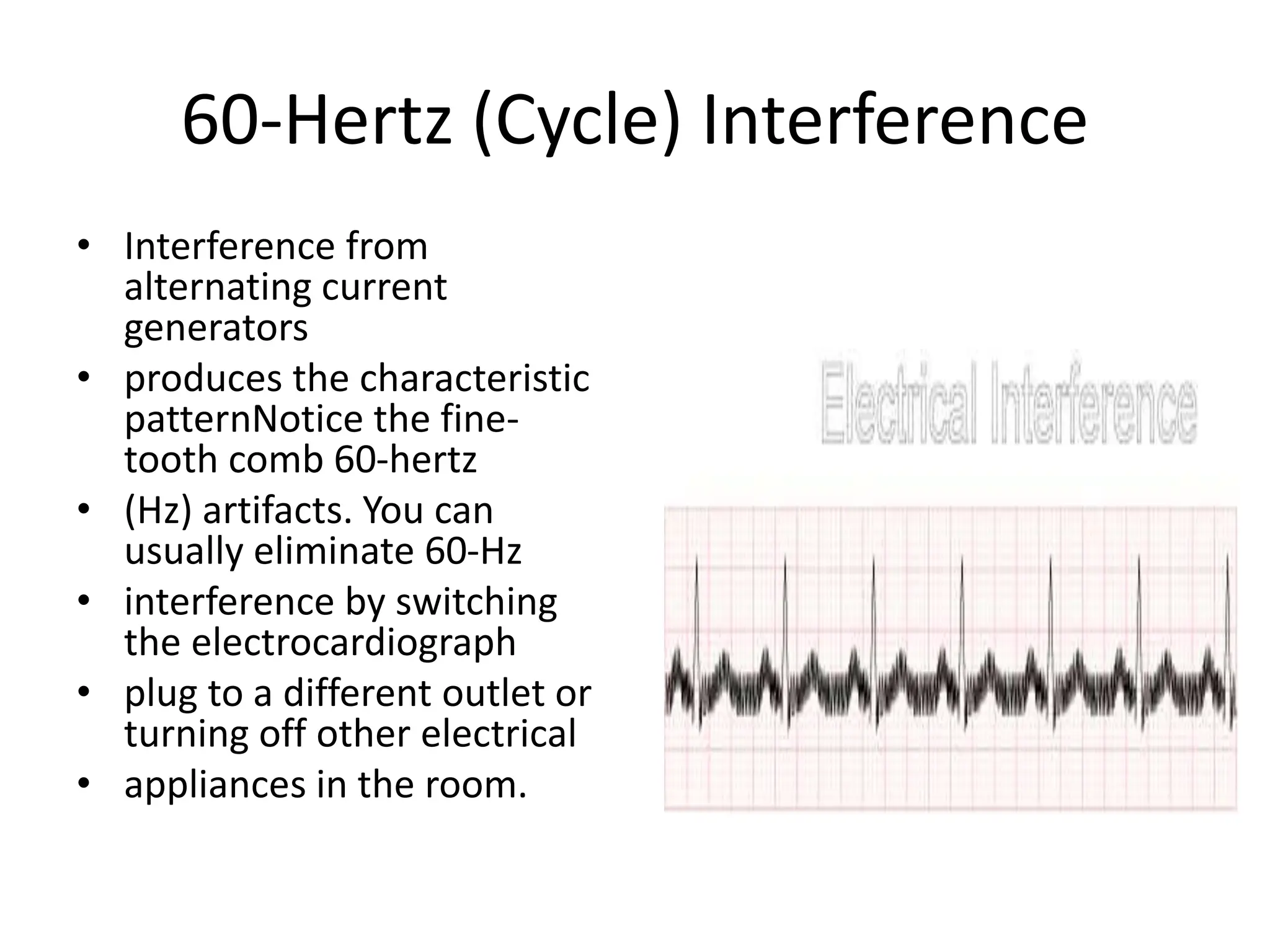 ARTIFACTS IN ECG.pptx