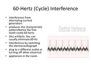 ARTIFACTS IN ECG.pptx