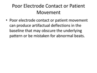 ARTIFACTS IN ECG.pptx