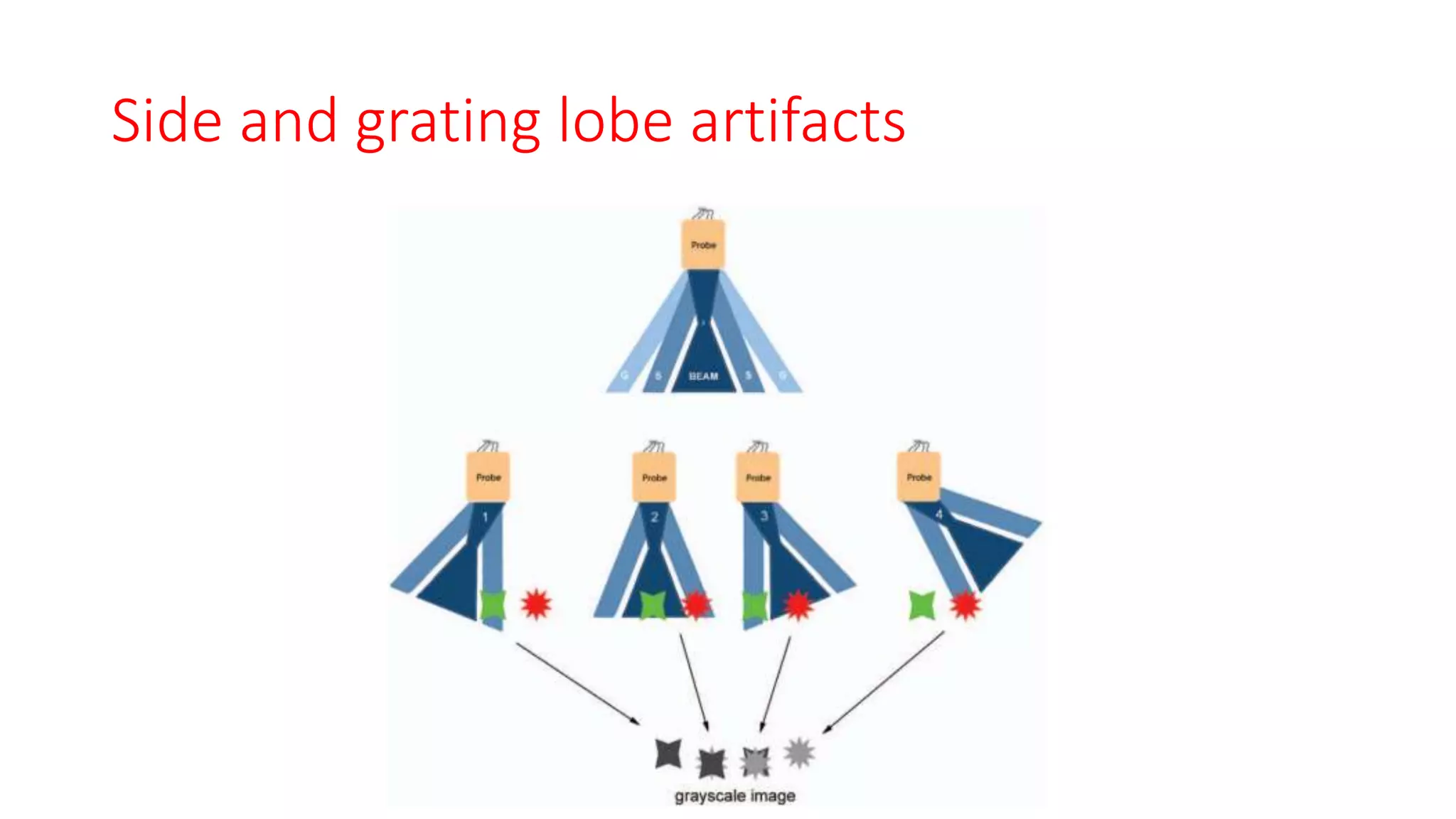 ARTIFACTS IN ECHO-1.pptx