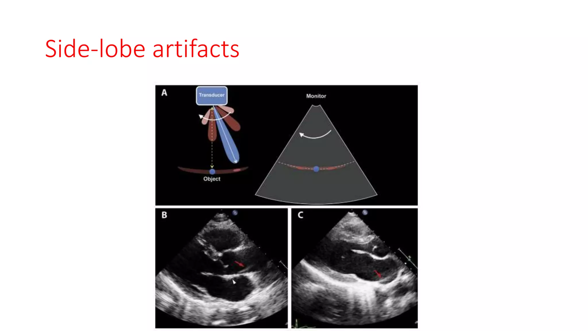 ARTIFACTS IN ECHO-1.pptx