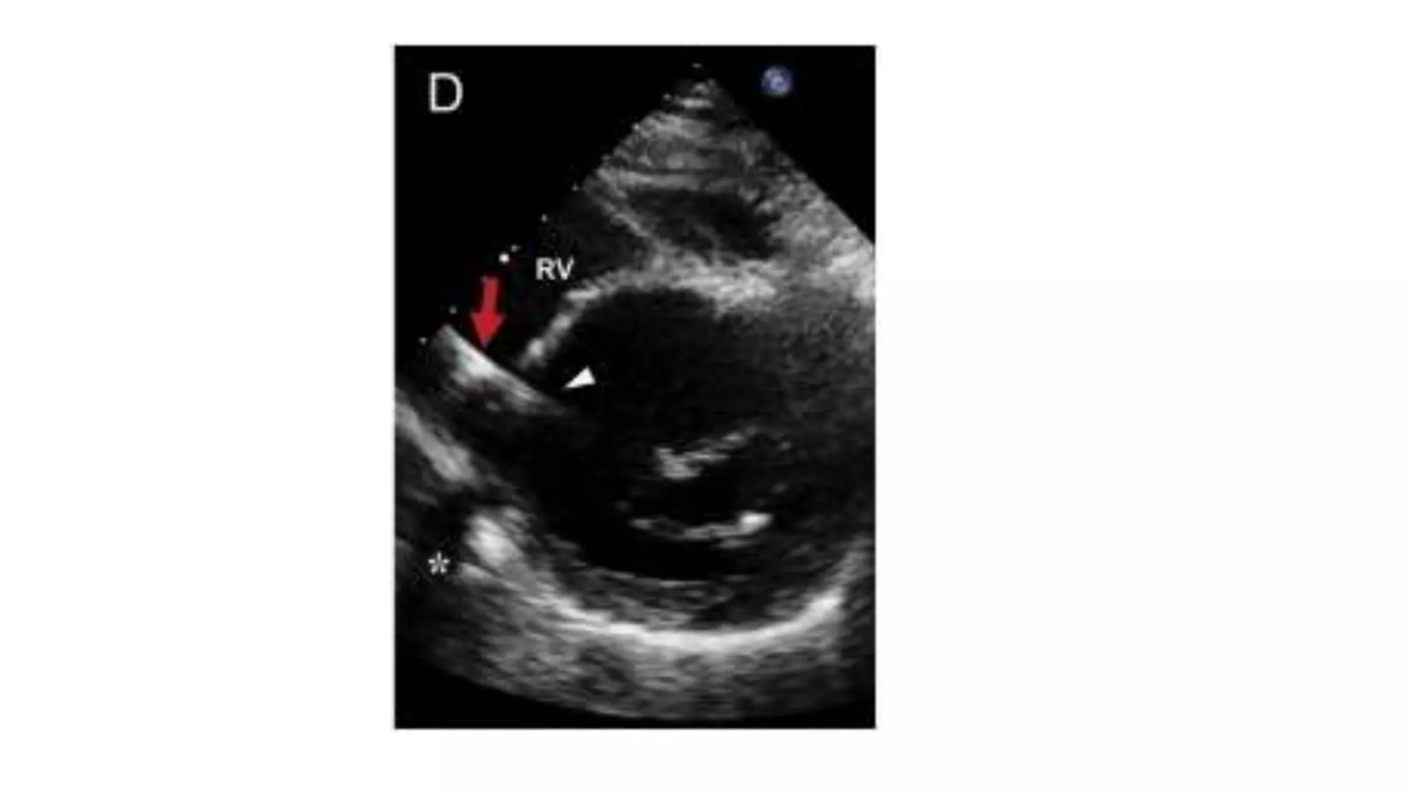 ARTIFACTS IN ECHO-1.pptx