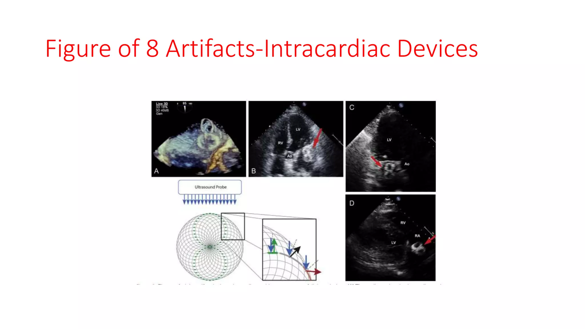ARTIFACTS IN ECHO-1.pptx