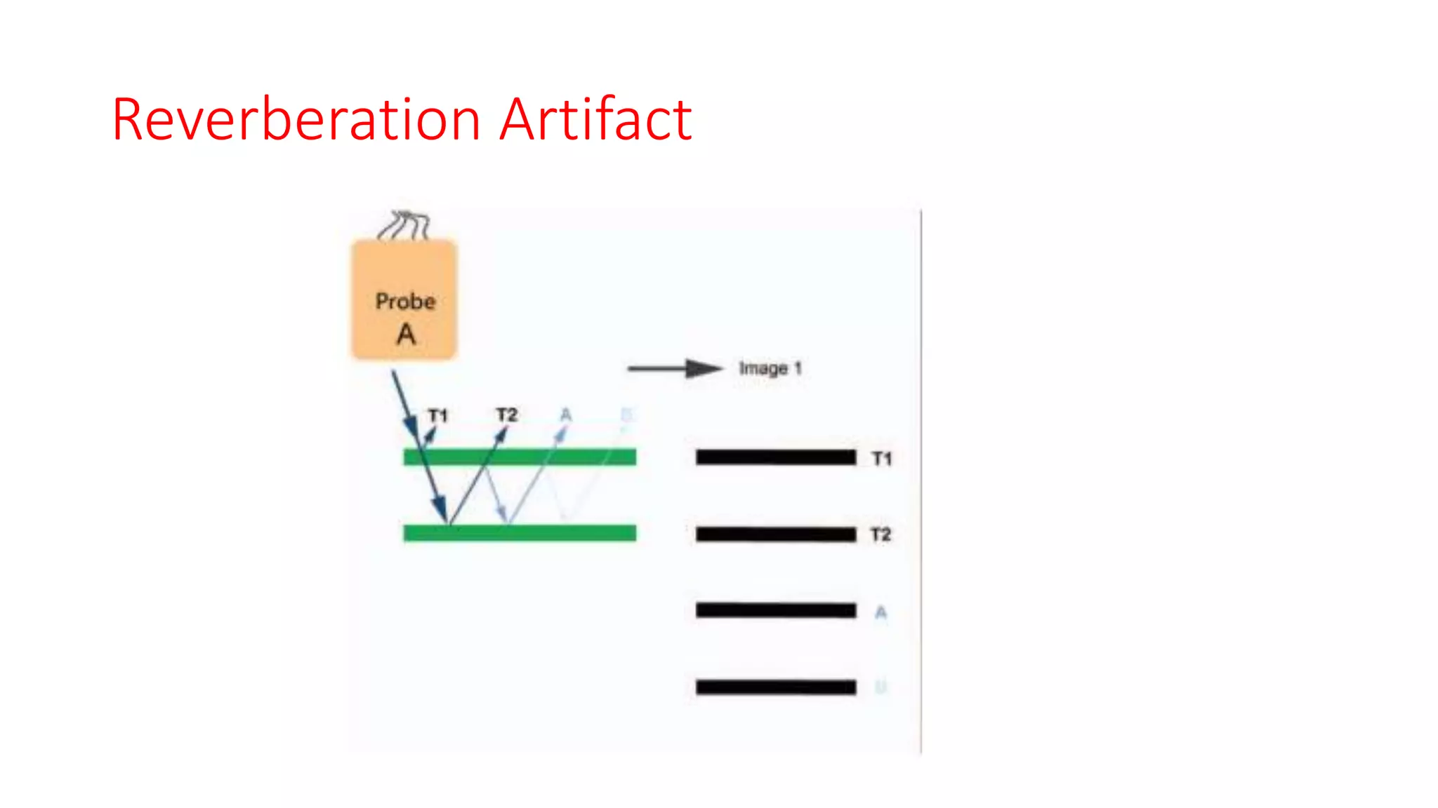 ARTIFACTS IN ECHO-1.pptx