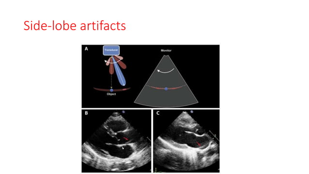 ARTIFACTS IN ECHO-1.pptx