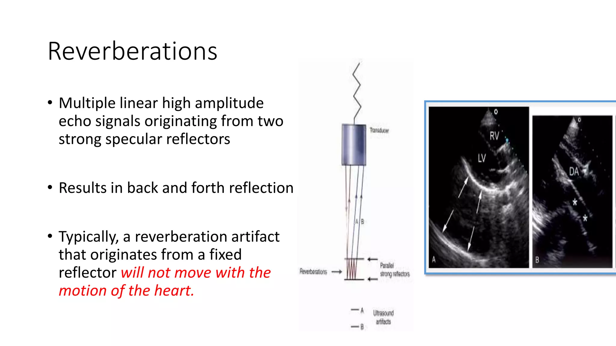 Artifacts in echocardiography | PPTX