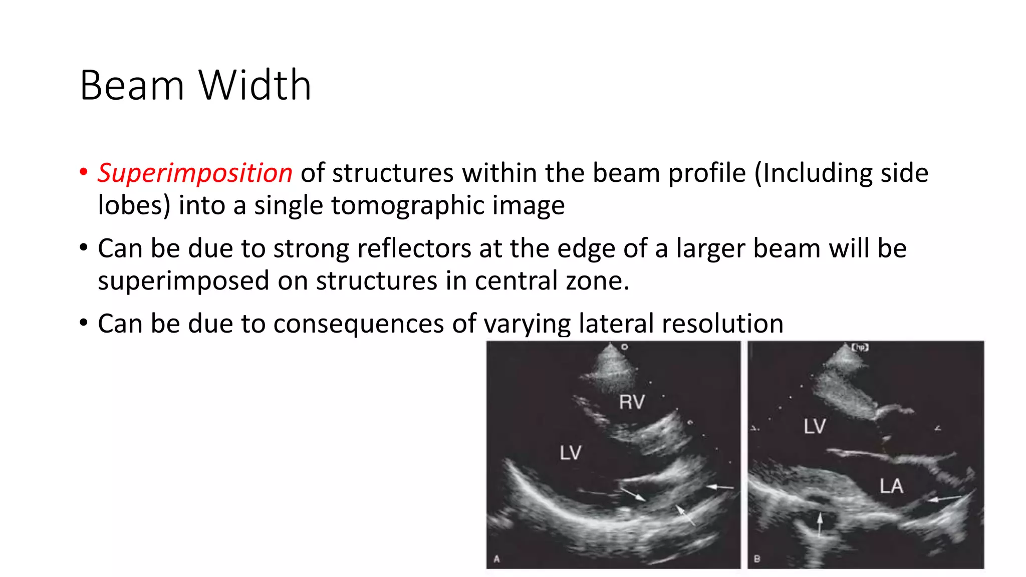 Artifacts in echocardiography | PPTX