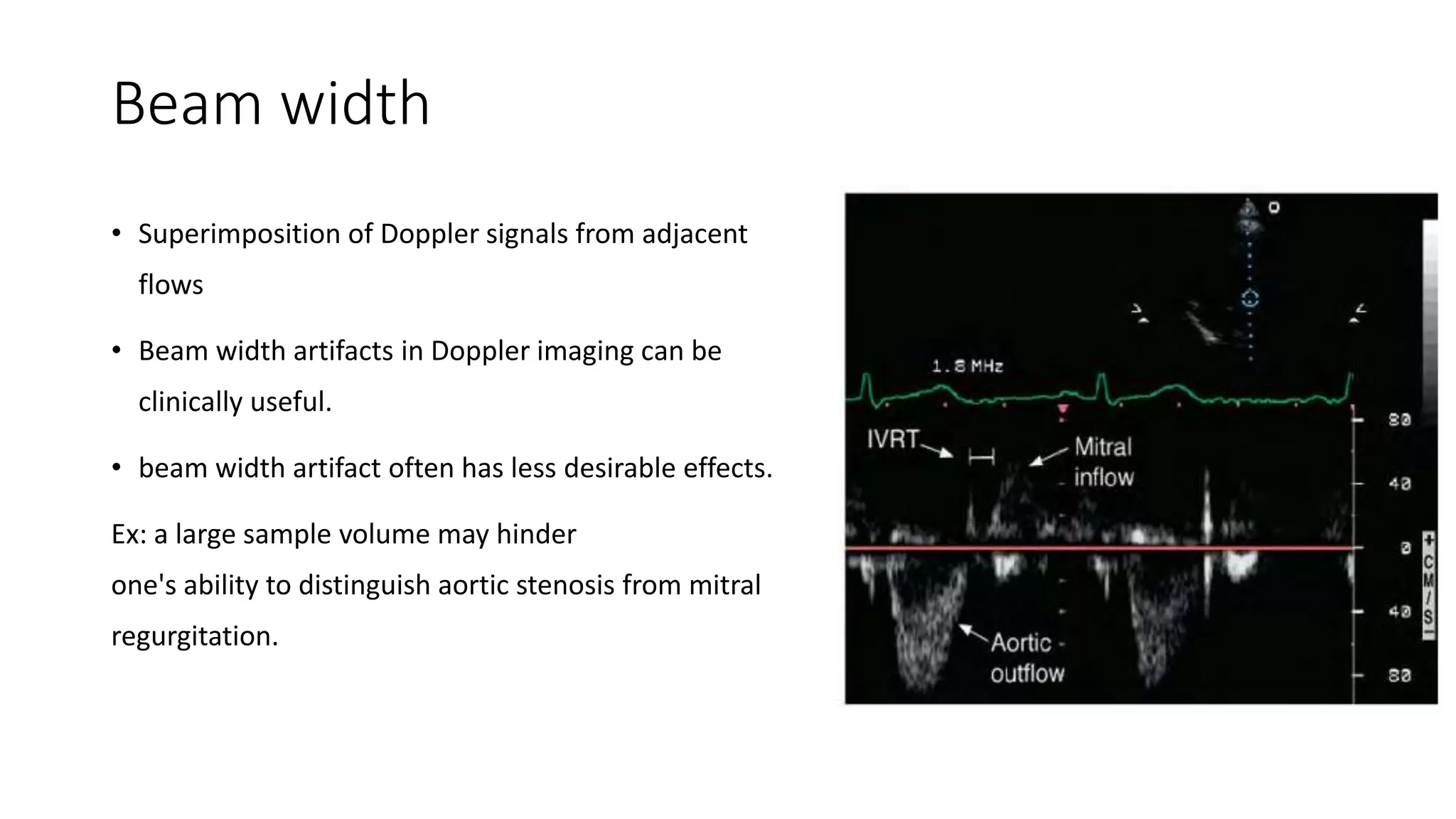 Artifacts in echocardiography | PPTX