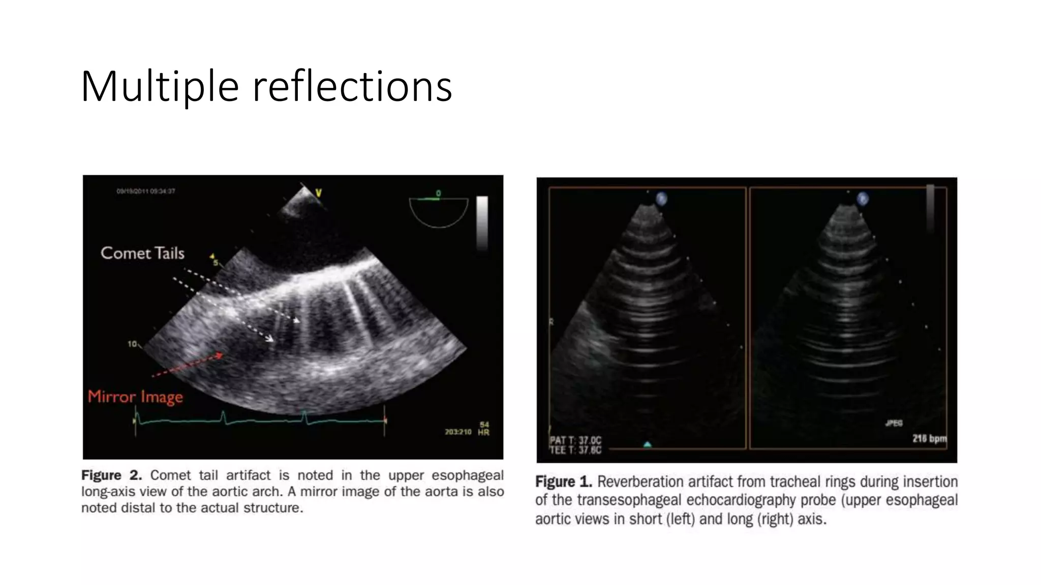 Artifacts in echocardiography | PPTX | Digital Audio | Computer Software and Applications