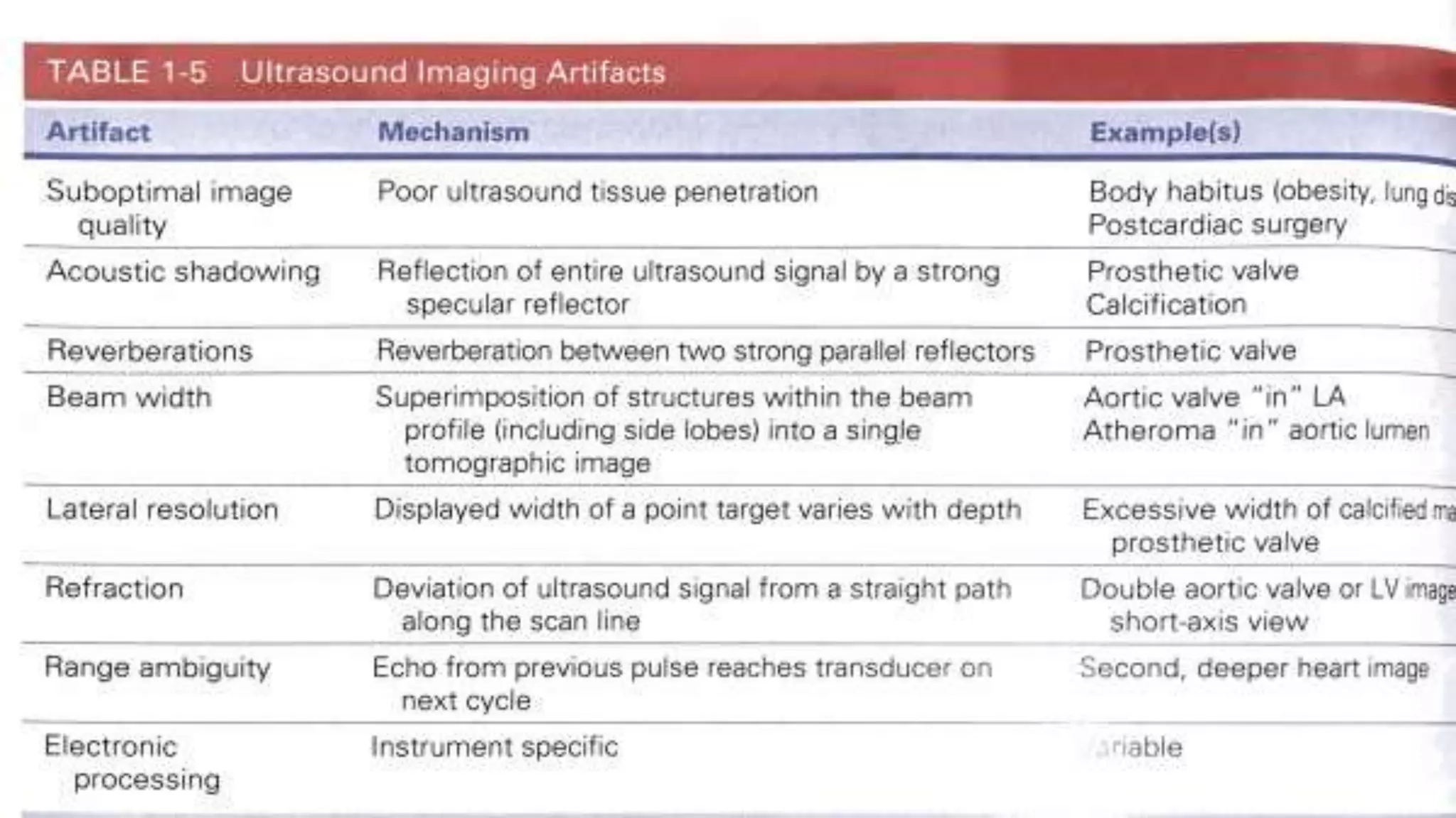 Artifacts in echocardiography | PPTX