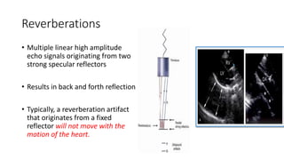 Artifacts in echocardiography | PPTX