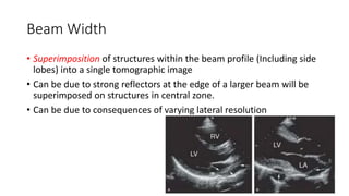 Artifacts in echocardiography | PPTX