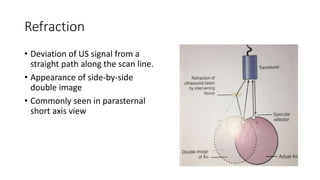 Artifacts in echocardiography | PPTX | Digital Audio | Computer Software and Applications