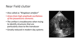 Artifacts in echocardiography | PPTX