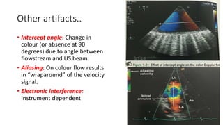 Artifacts in echocardiography | PPTX