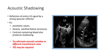Artifacts in echocardiography | PPTX