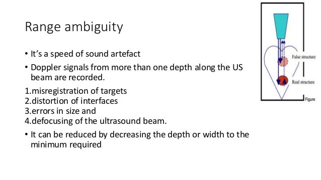 Ultrasound Range Ambiguity Artifact Ultrasound Imaging Artifacts: How