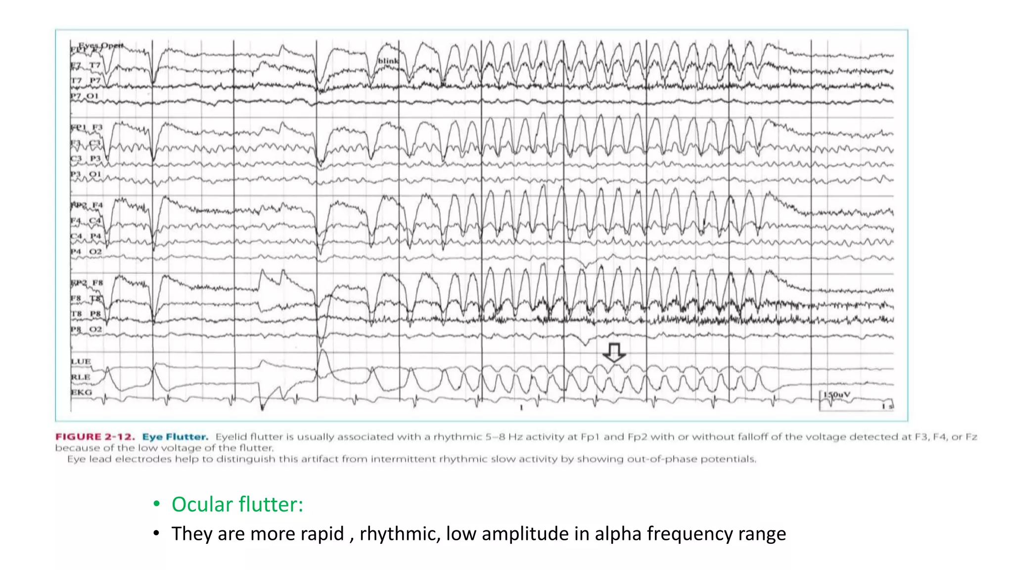 ARTIFACTS IN EEG.pptx