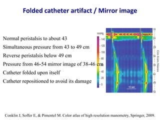 Artifacts in esophageal high resolution manometry | PPTX