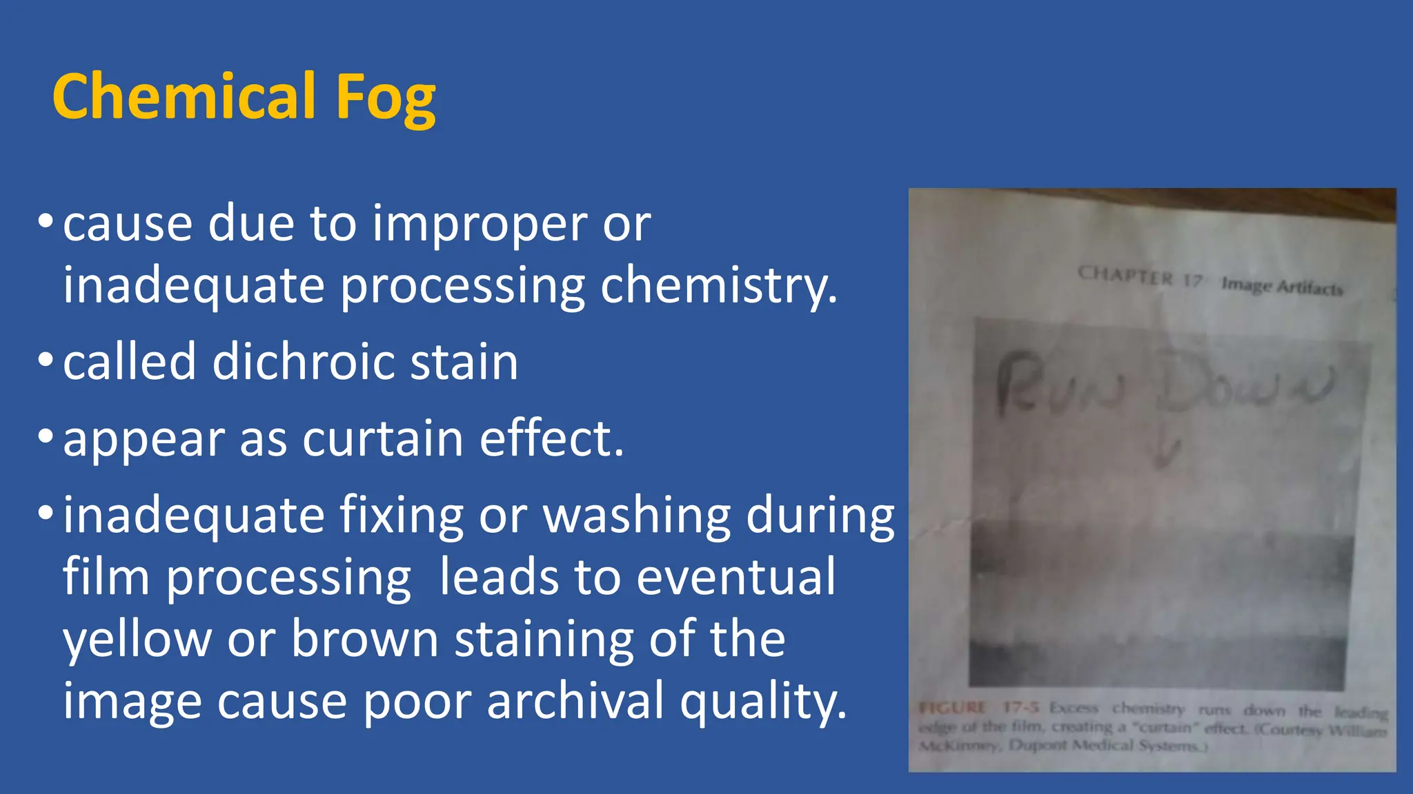 ARTIFACTS IN GENERAL radiography for radiodept.pptx
