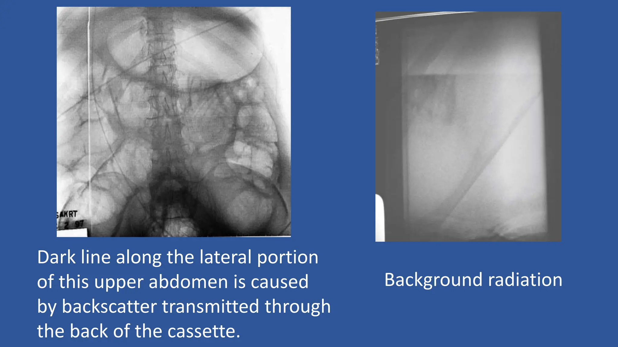 ARTIFACTS IN GENERAL radiography for radiodept.pptx