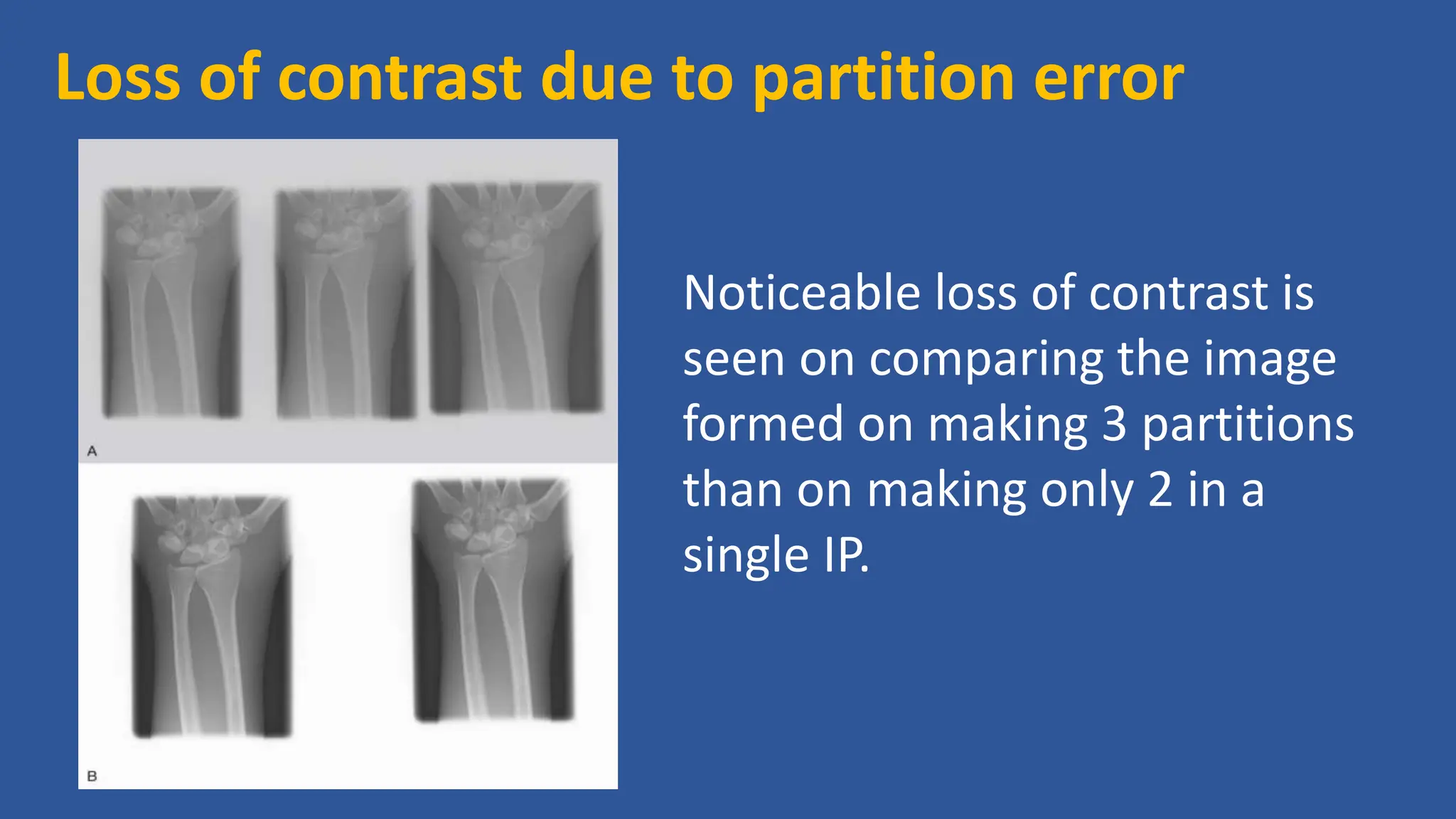 ARTIFACTS IN GENERAL radiography for radiodept.pptx