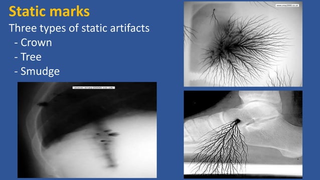 ARTIFACTS IN GENERAL radiography for radiodept.pptx
