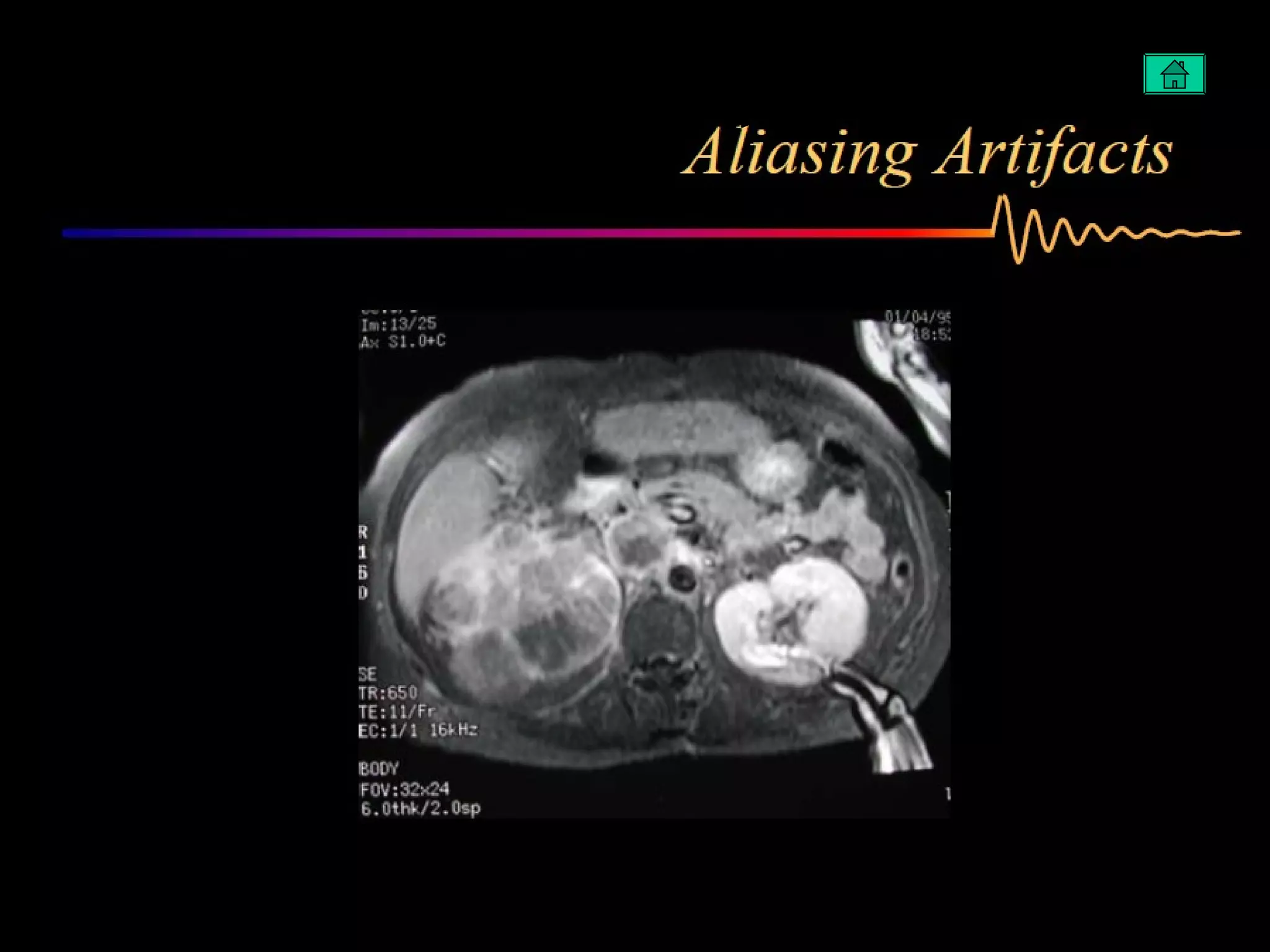 Artifacts in MRI | PPT