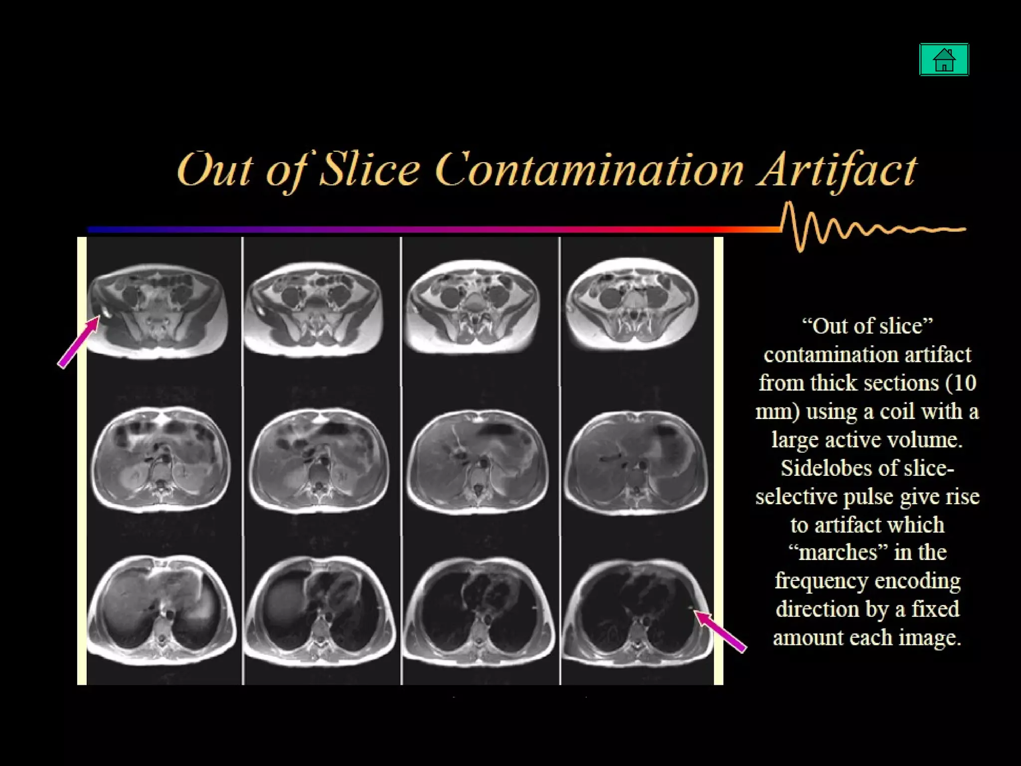 Artifacts in MRI | PPT
