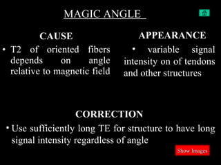 Artifacts in MRI | PPT