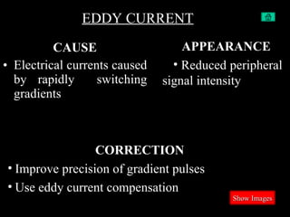 Artifacts in MRI | PPT