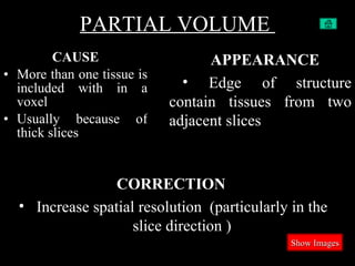 Artifacts in MRI | PPT
