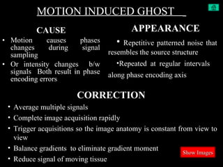 Artifacts in MRI | PPT
