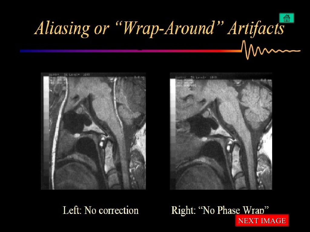 Artifacts in MRI