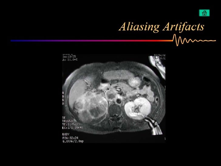 Artifacts in MRI
