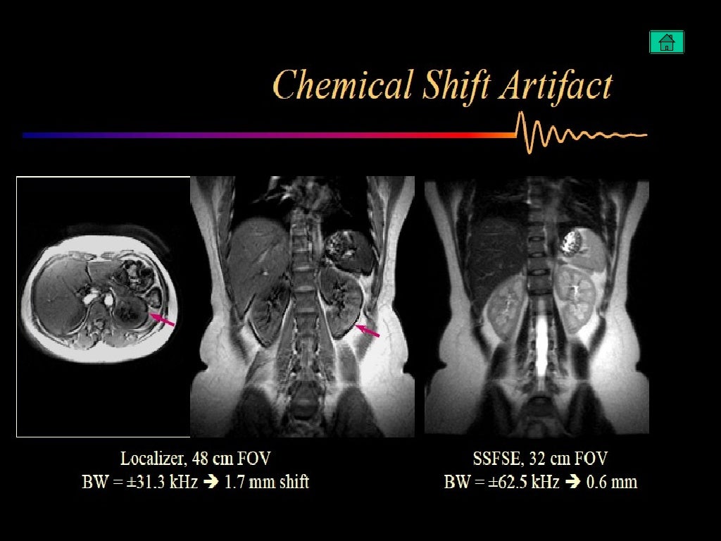 Artifacts in MRI