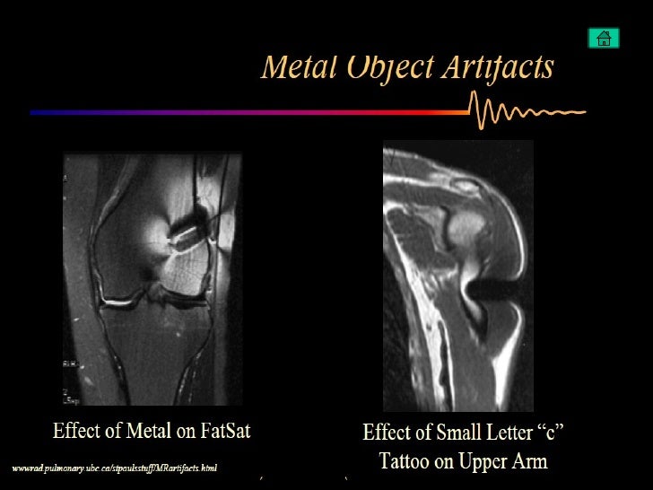 Artifacts in MRI