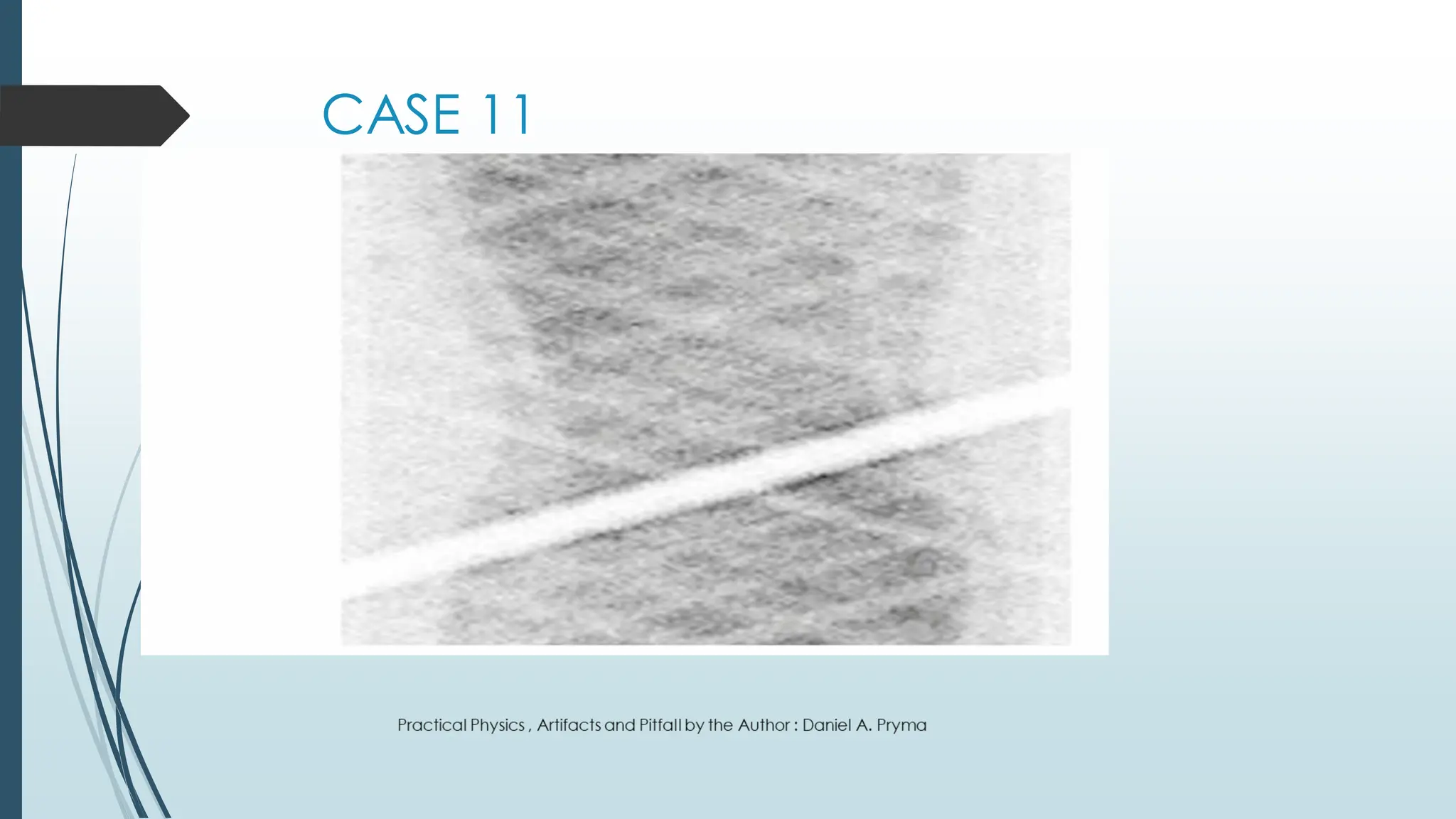 Artifacts in Nuclear Medicine with Identifying and resolving artifacts ...