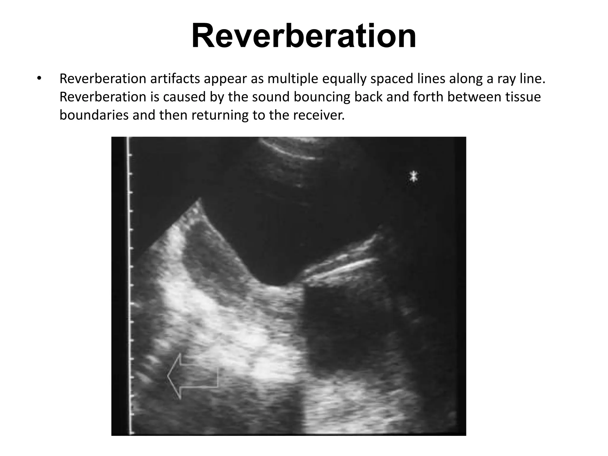 Artifacts interpretation 3.pptx