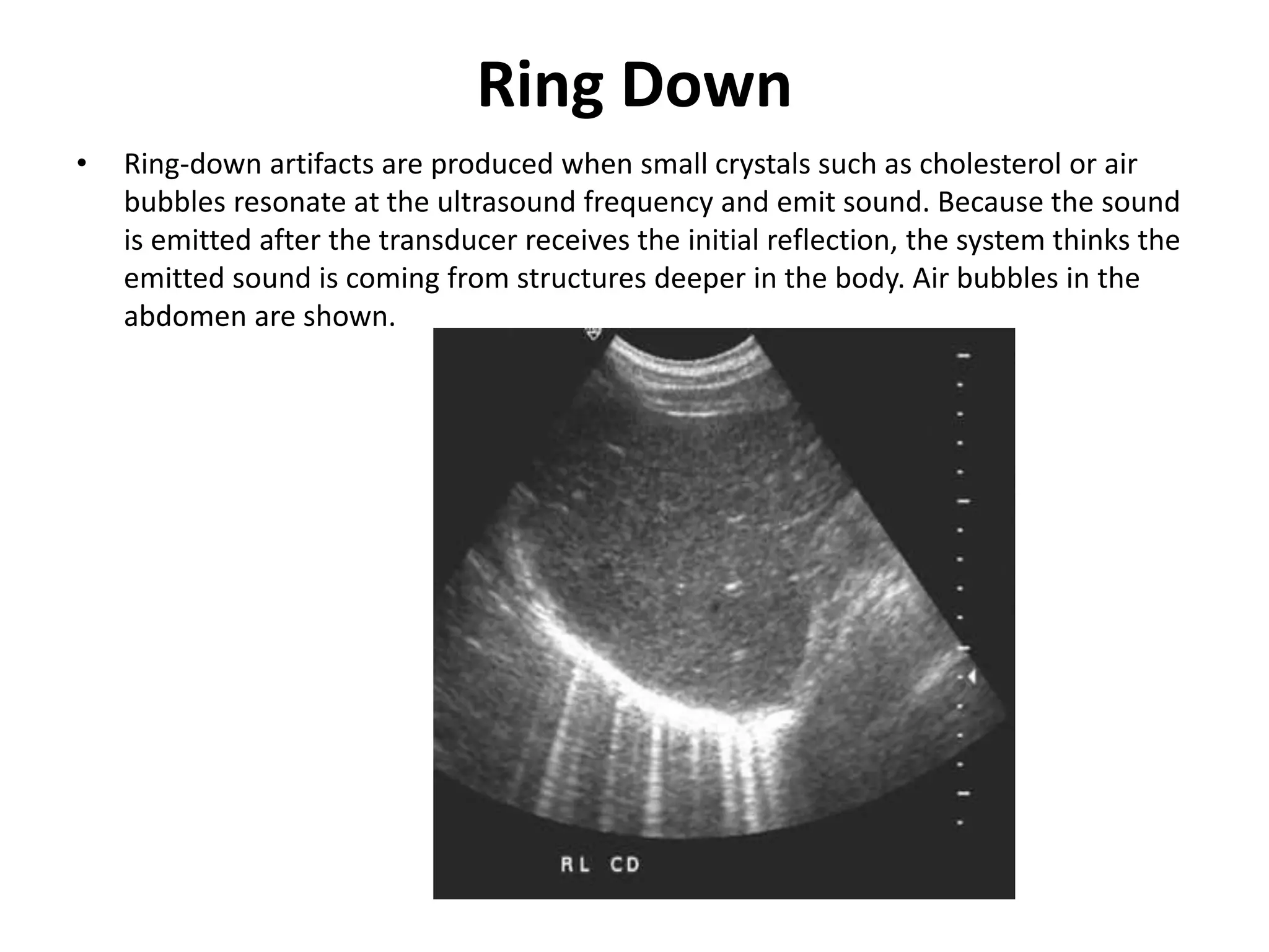 Artifacts interpretation 3.pptx