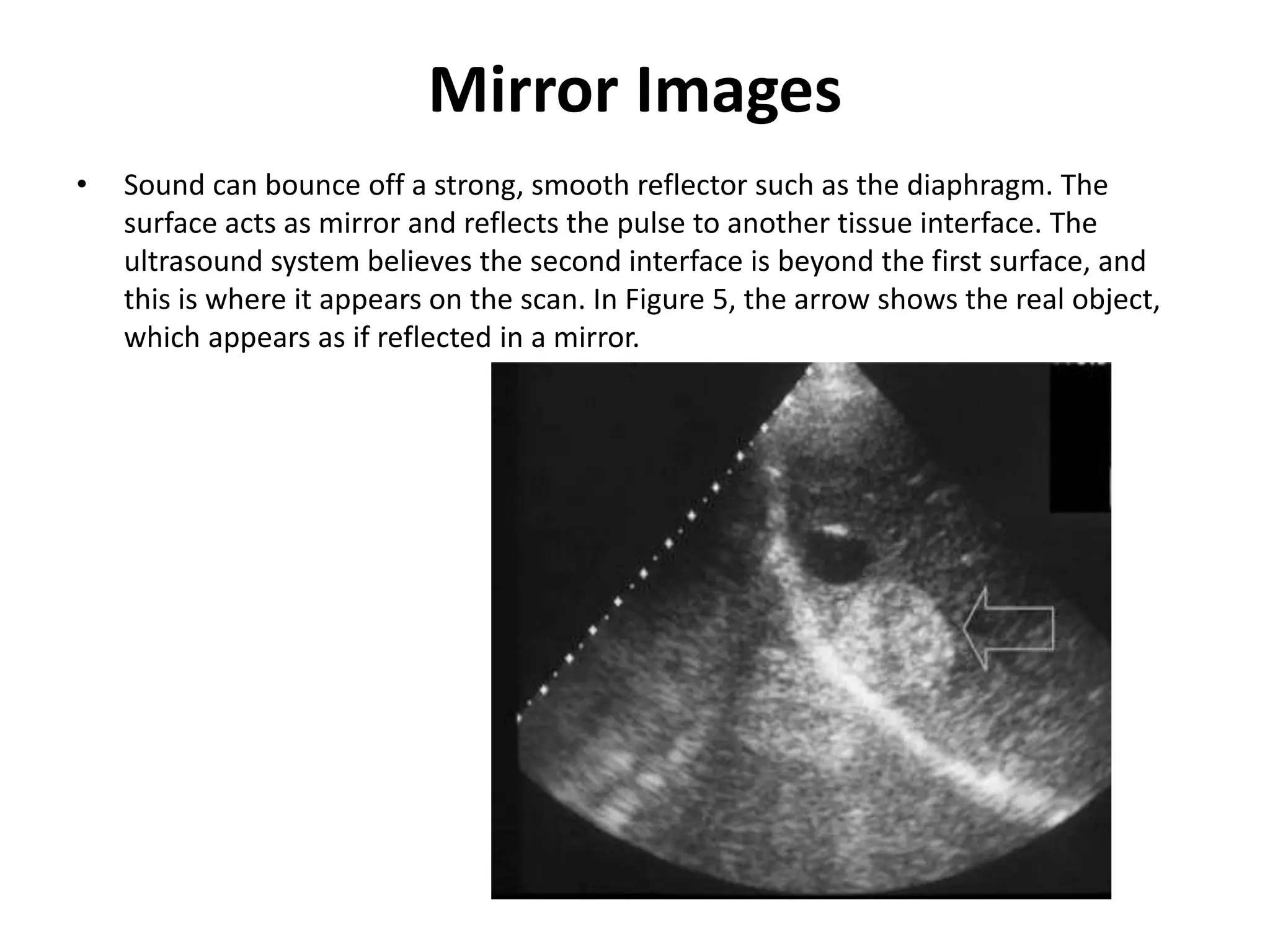 Artifacts interpretation 3.pptx