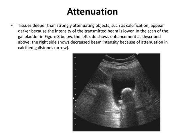 Artifacts interpretation 3.pptx
