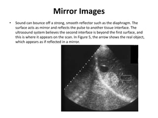 Artifacts interpretation 3.pptx