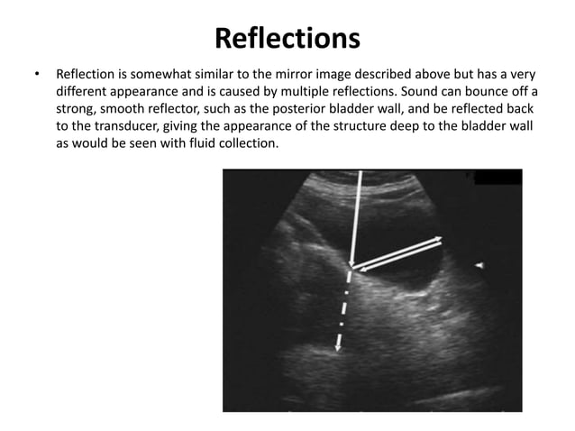 Artifacts interpretation 3.pptx