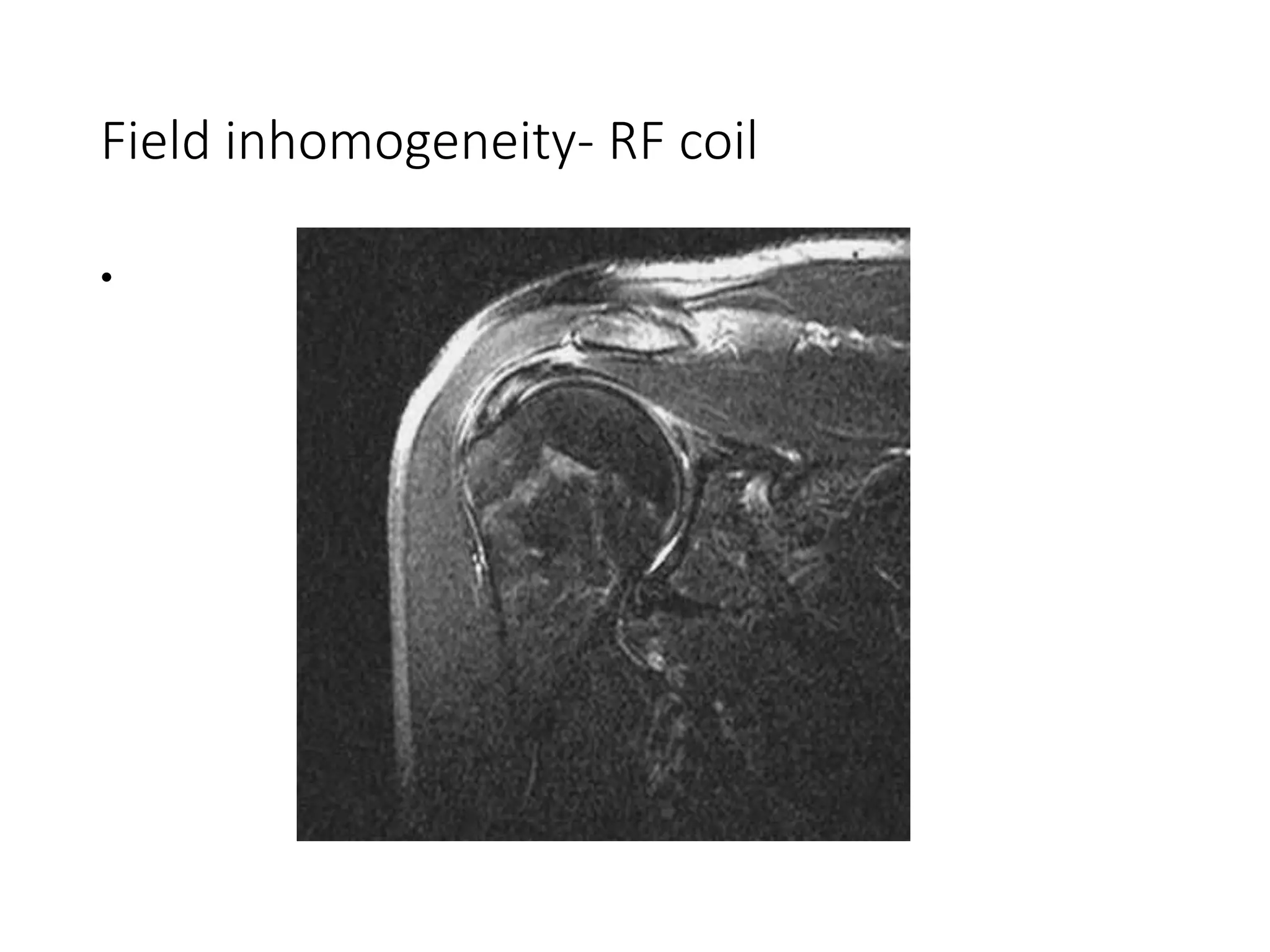 Mri Artifacts Introduction Classification Types Ppt